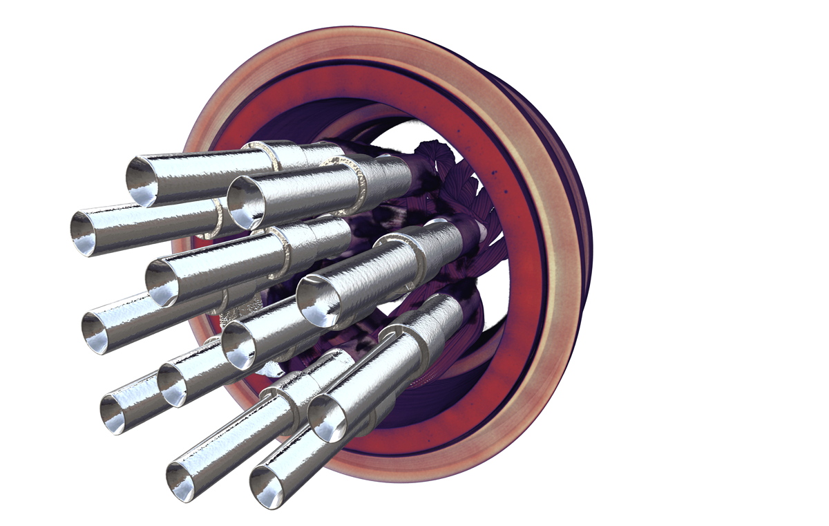 Dual Tube CT Systems Offer Incredible Versatility | North Star Imaging