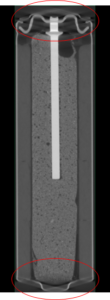 Advantages of Helical (Spiral) CT Scanning | North Star Imaging